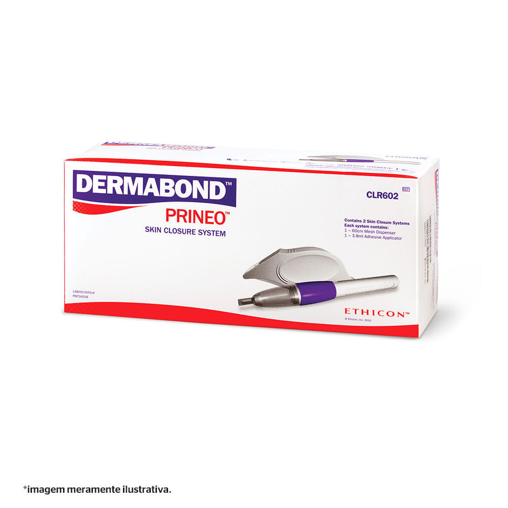 DERMABOND PRINEO 60CM - Loja oficial J&J Medtech